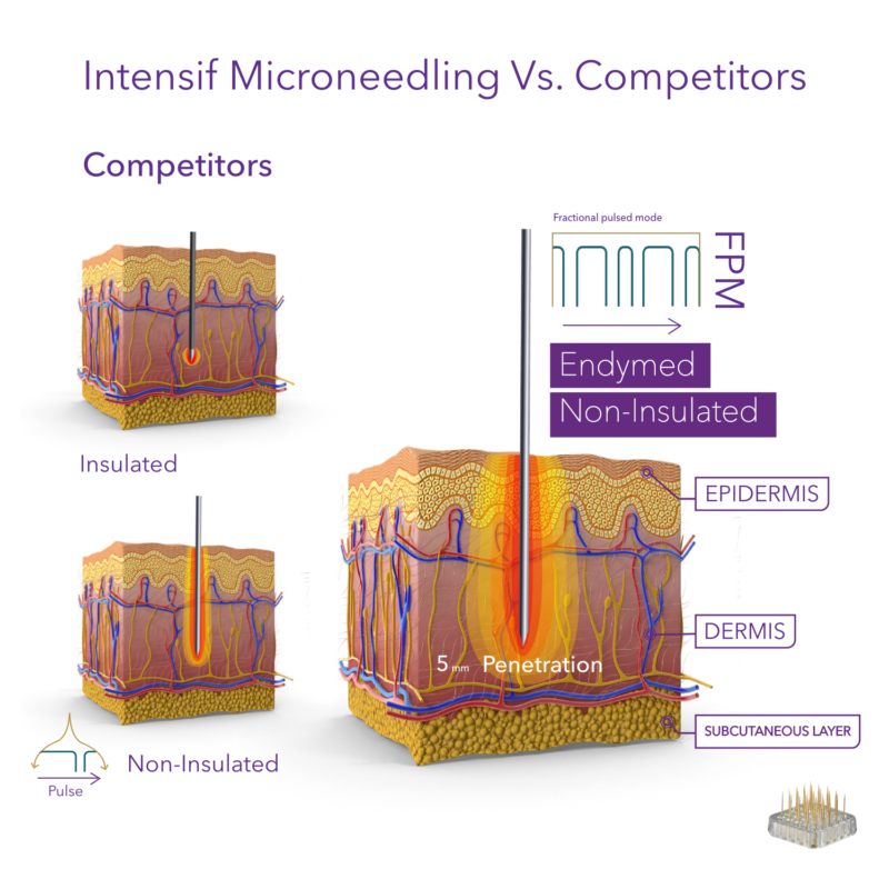 Illustrations - ENDYMED